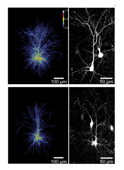 Resolving and Rescuing Developmental Miswiring in a Mouse Model of ...